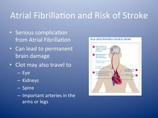 Atrial fibrillation and stroke | PDF