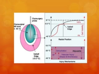 CRYOSURGERY BY DR SUCHITRA SURYAVANSHIPATIL | PPTX