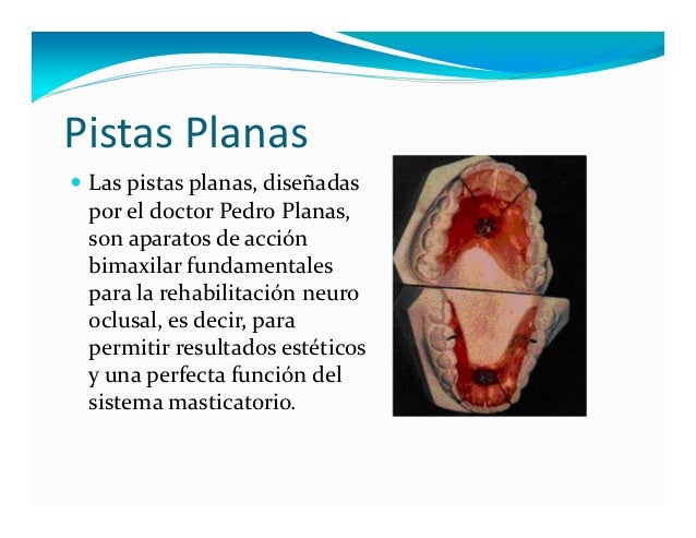 14151480 pistas-planaspresentacion