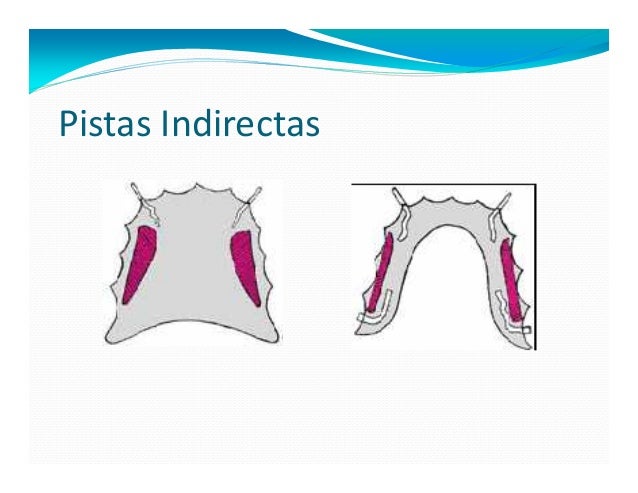 14151480 pistas-planaspresentacion