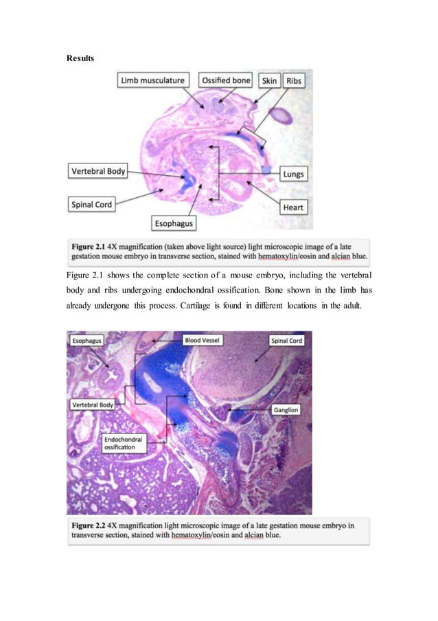 Chondrocyte Cell Profile Report | DOCX | Bone and Joint Conditions ...