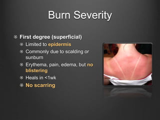 141584757-Burns-Presentation.pptx