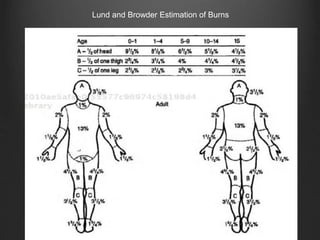 141584757-Burns-Presentation.pptx