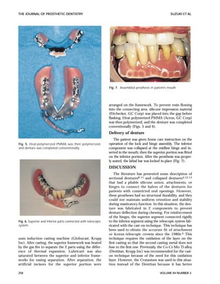 Complete denture complications 14_2000__Suzuky_Sectional collapsed ...