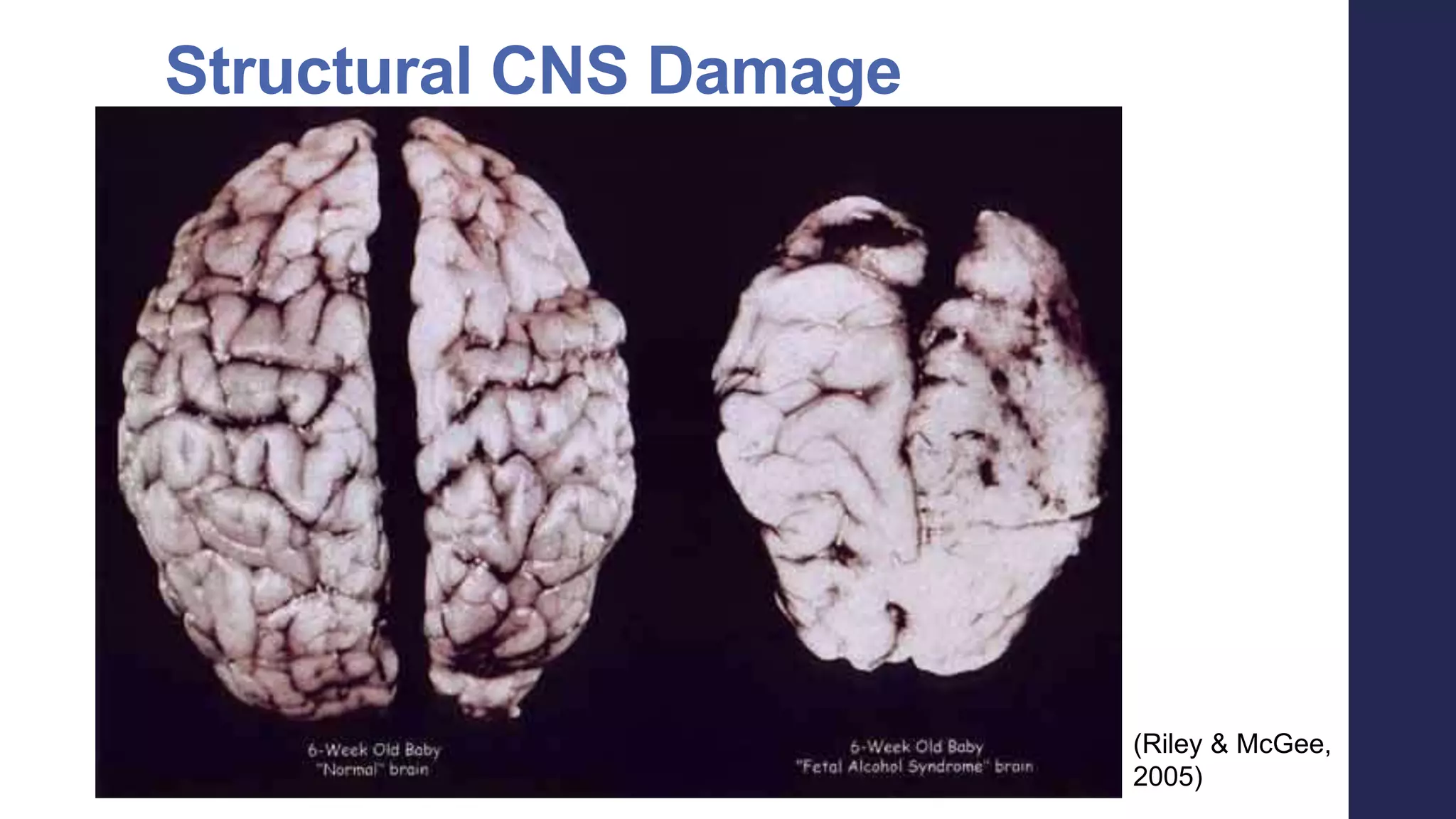 FINAL FASD SURP presentation | PPT