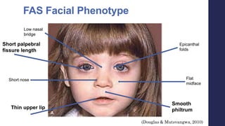 FINAL FASD SURP presentation | PPTX
