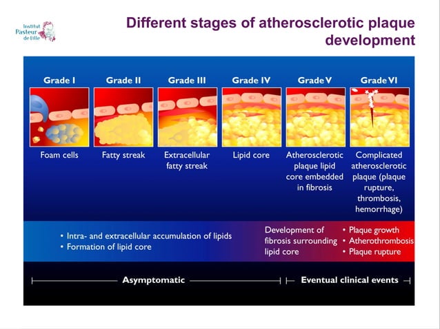 Case-Report stemi lateral pada jantung dan pembuluh darah | PPT