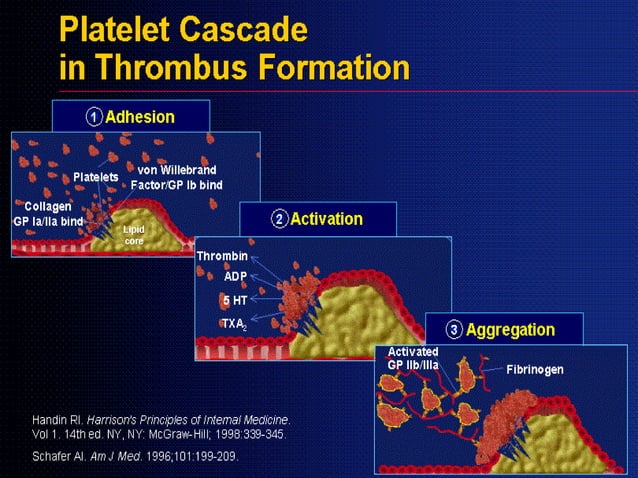 Case-Report stemi lateral pada jantung dan pembuluh darah | PPT
