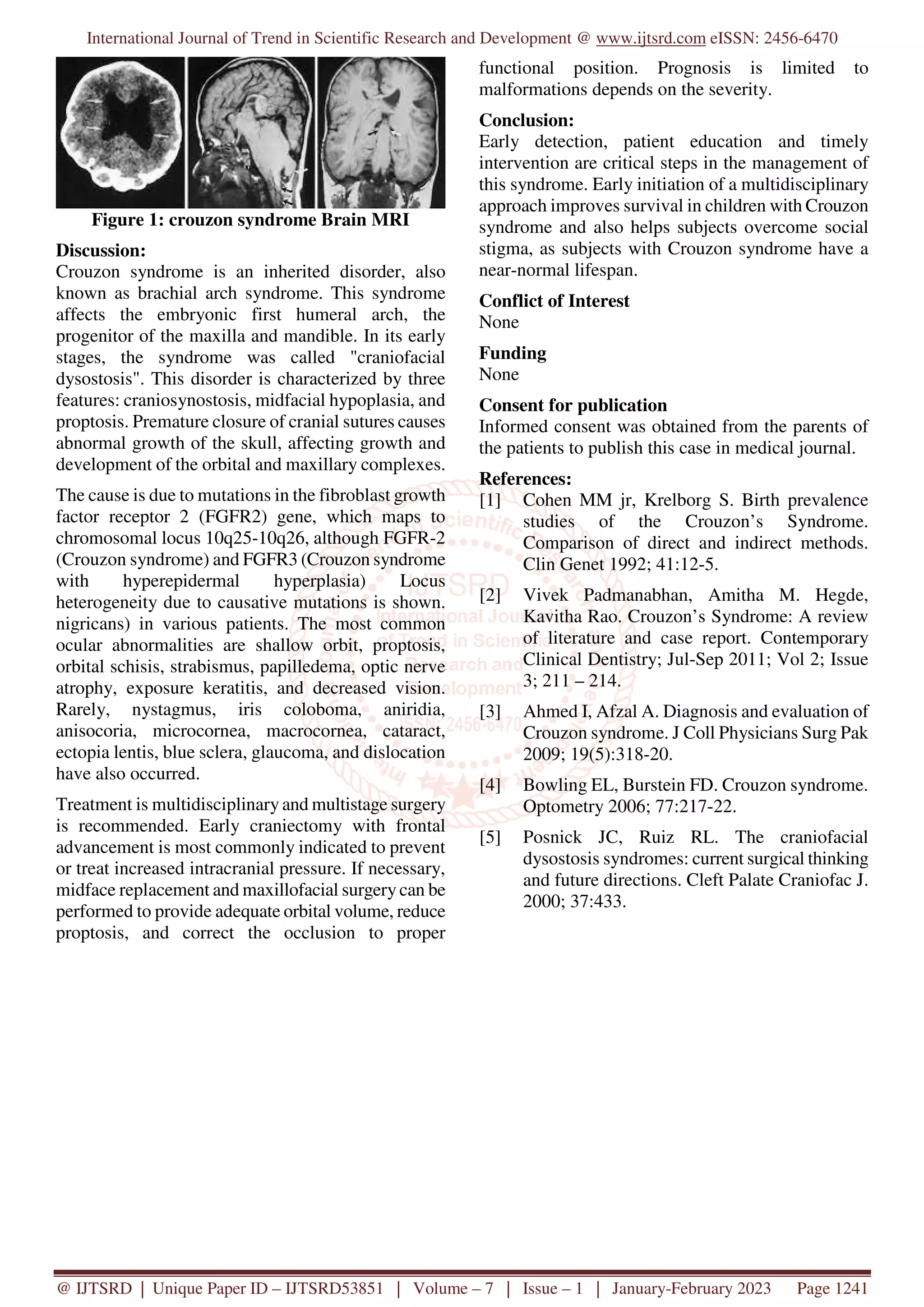 Crouzon Syndrome A Case Report | PDF | Ear, Nose and Throat Conditions ...