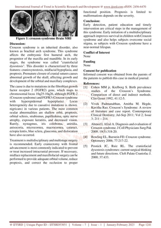 Crouzon Syndrome A Case Report | PDF | Ear, Nose and Throat Conditions | Diseases and Conditions