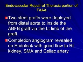 Hybrid repair of Thoracoabdominal Aneurysm | PPT