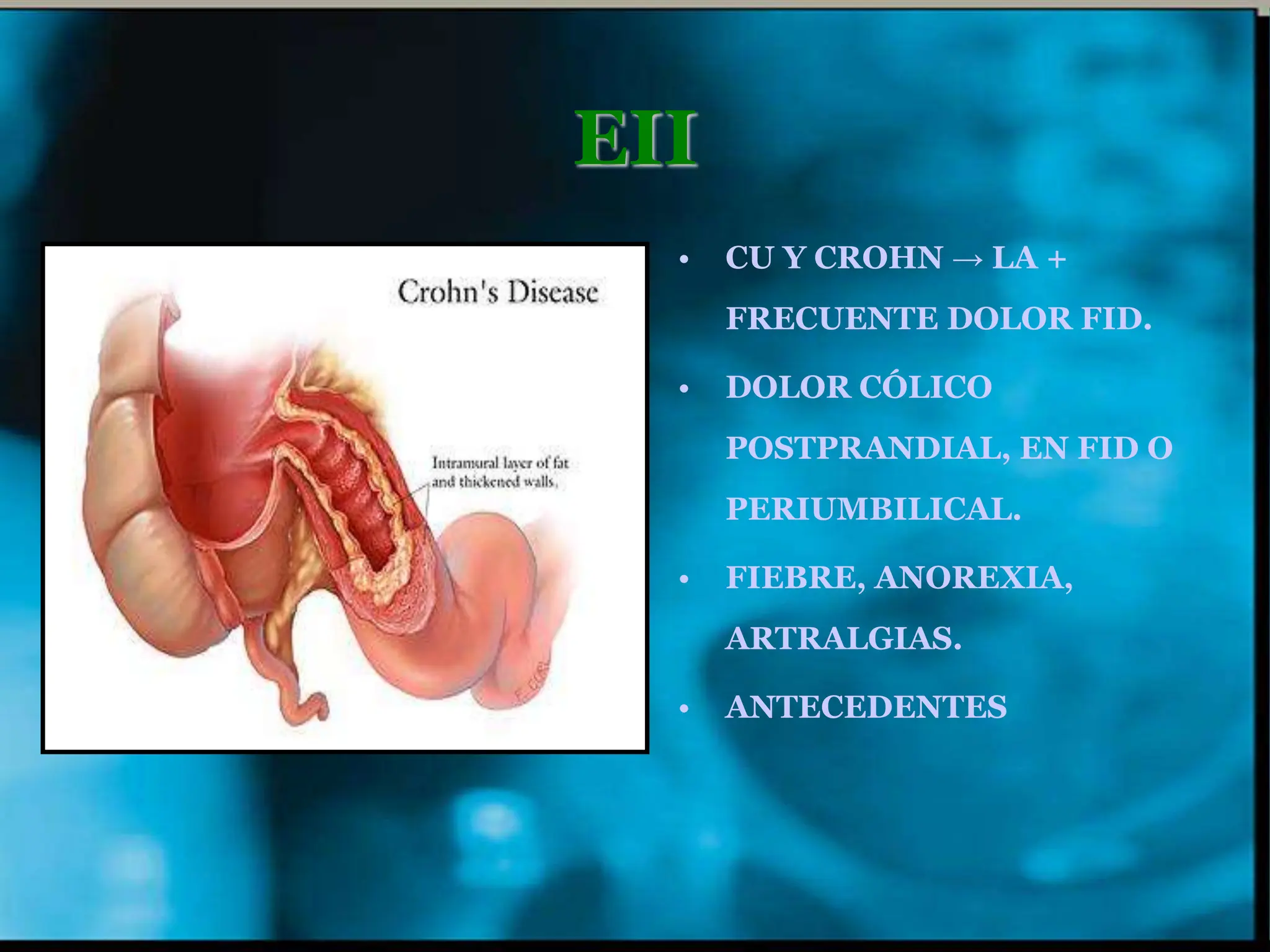 Enfermedad inflamatoria intestinal medicina | PPT