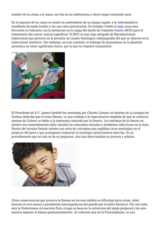 Fimosis En Adultos | PDF