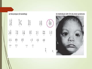 Structural changes.ppt