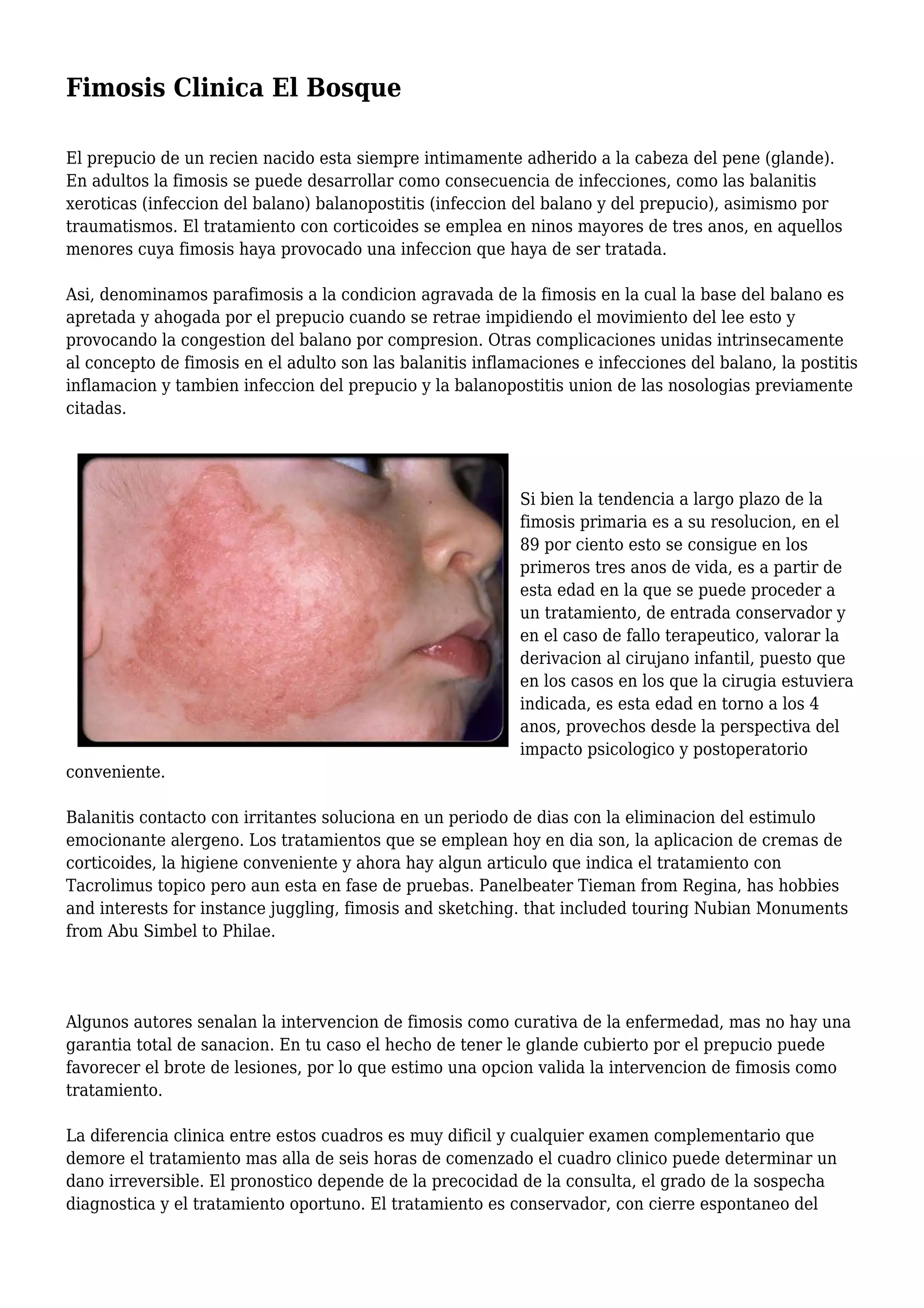 Fimosis Clinica El Bosque | PDF