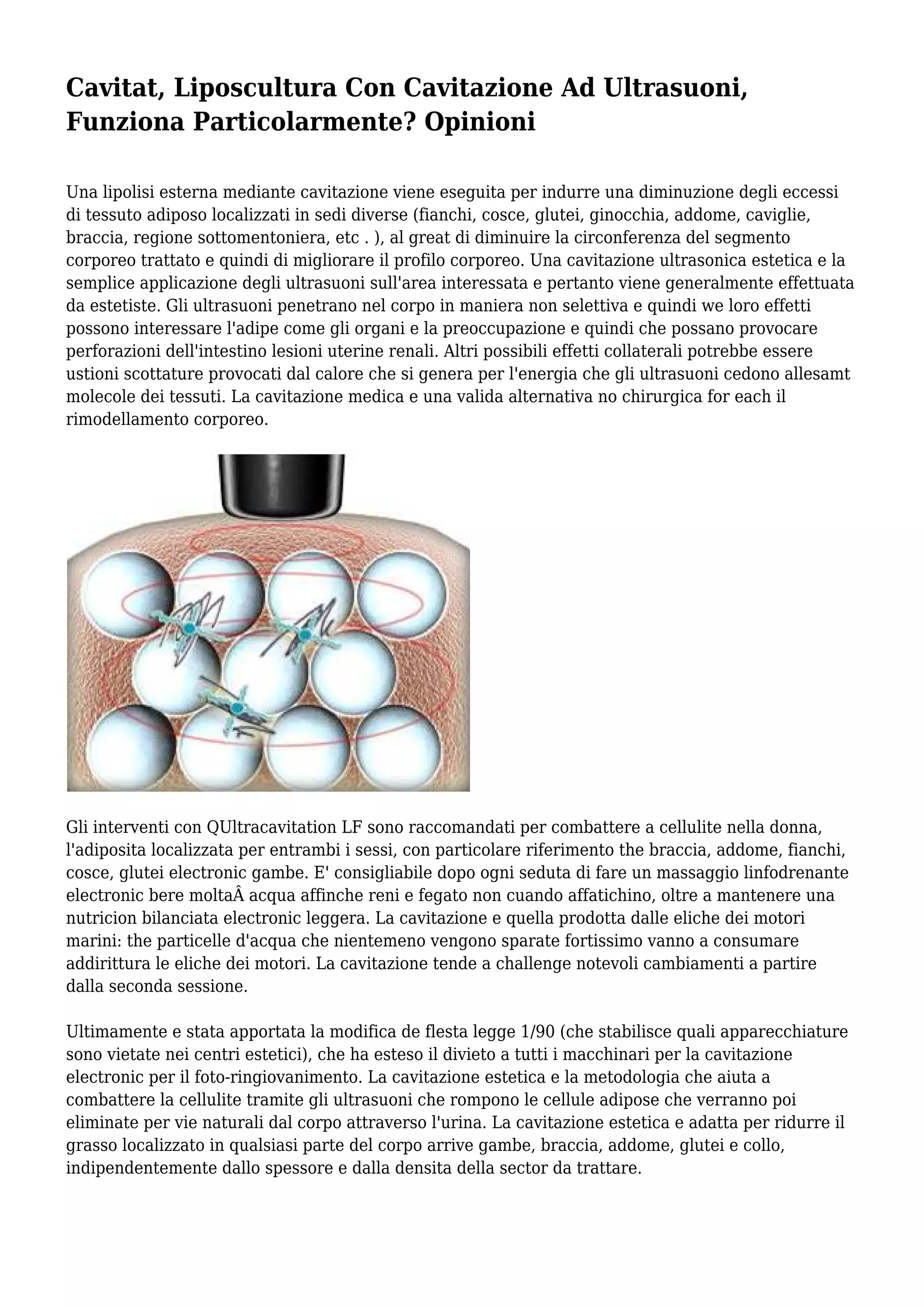 Cavitat, Liposcultura Con Cavitazione Ad Ultrasuoni, Funziona ...