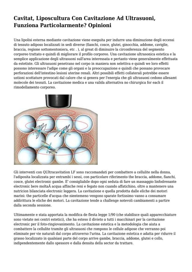 Cavitat, Liposcultura Con Cavitazione Ad Ultrasuoni, Funziona ...