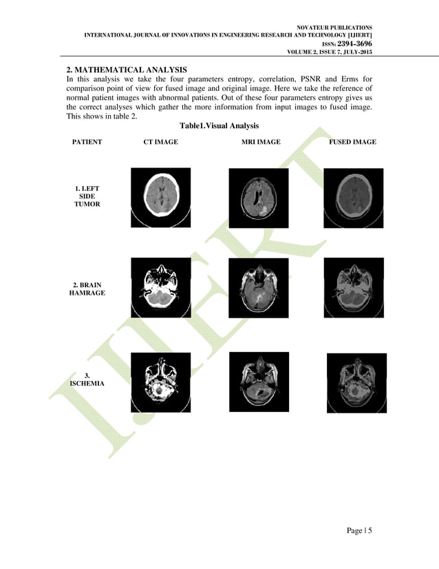 Analysis Of Biomedical Image Using Wavelet Transform Pdf 