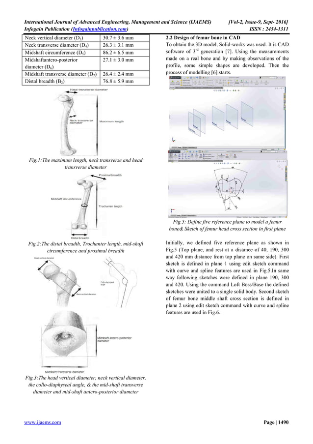 3 Dimensional Virtual Modelling of Human Femur Bone with Prosthetic ...