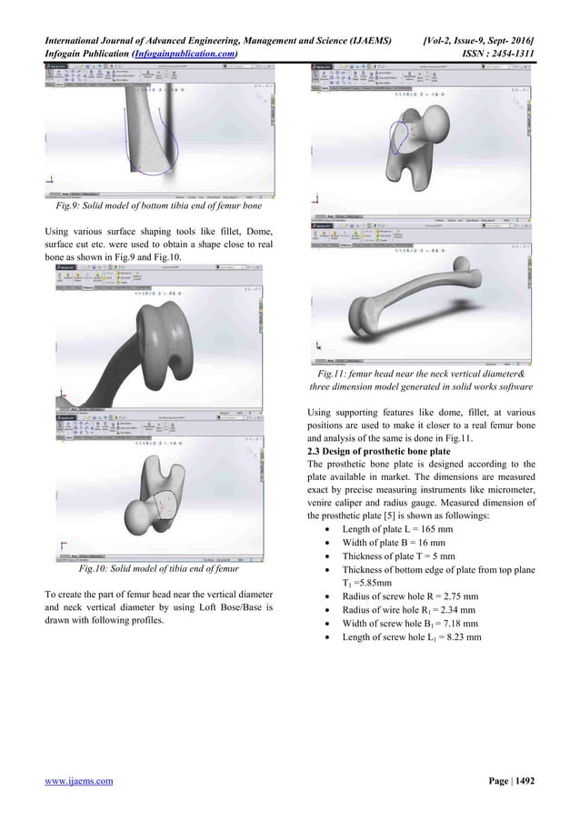 3 Dimensional Virtual Modelling of Human Femur Bone with Prosthetic ...