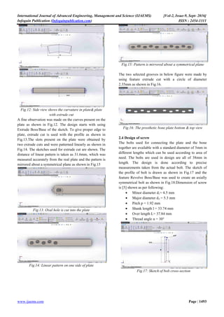 3 Dimensional Virtual Modelling of Human Femur Bone with Prosthetic ...