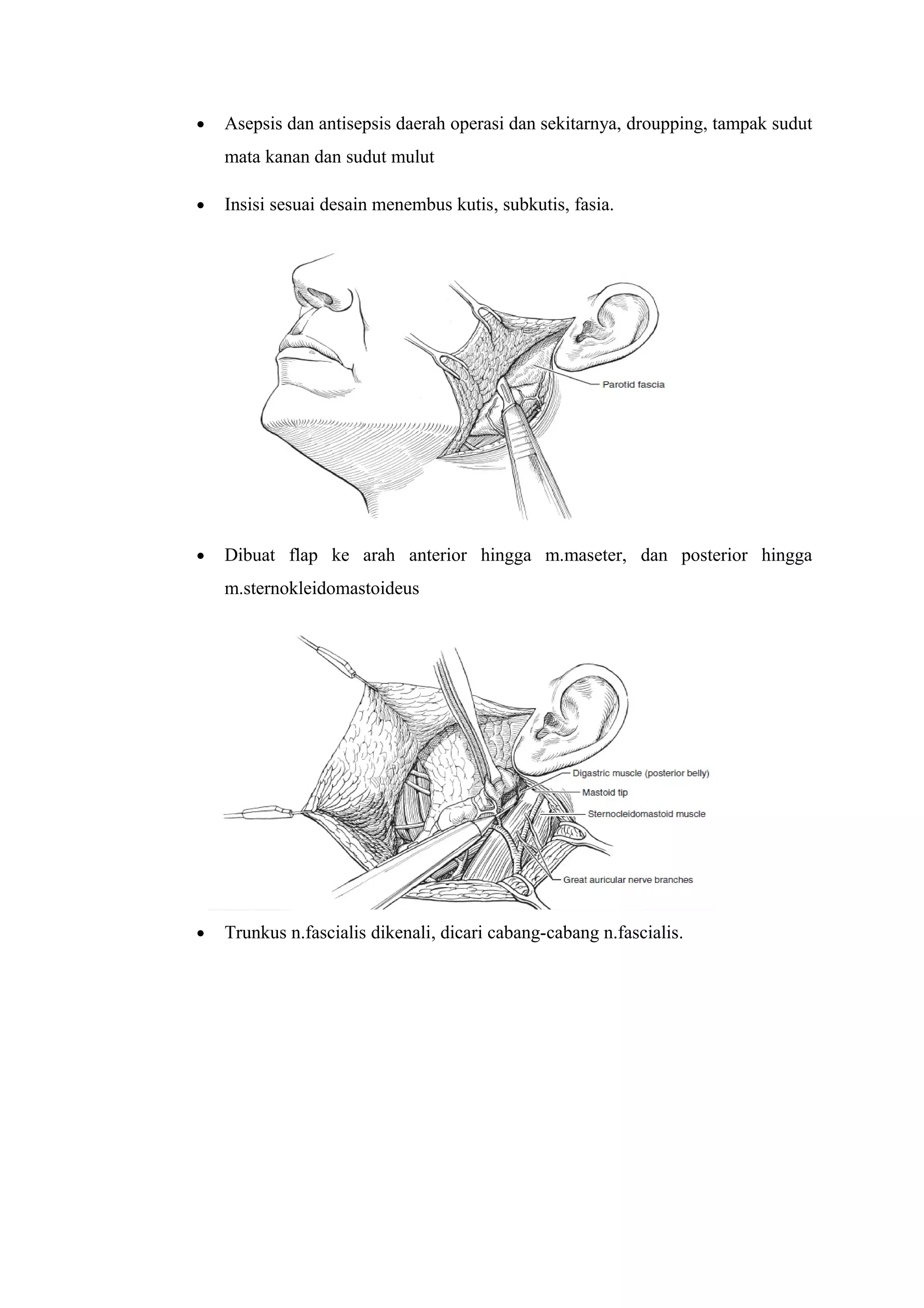 144455091 case-tumor-parotis | DOC
