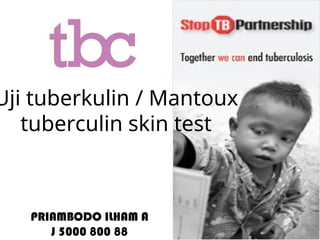 145411900-imunisasi test Mantoux-ppt.ppt