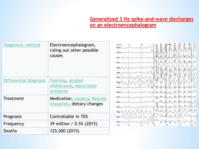 Epilepsy-Epidemiology,Signs and symptoms,Triggers,Seizures types,Causes ...