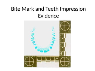 Bite Mark and Teeth Impression Evidences 12 | PPT