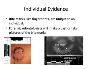 Bite Mark and Teeth Impression Evidences 12 | PPT