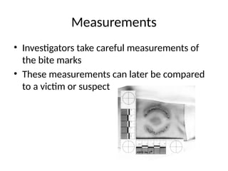 Bite Mark and Teeth Impression Evidences 12 | PPT