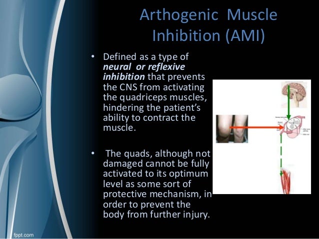 Quadriceps Arthogenic Muscle Inhibition and It’s Effects after TKR