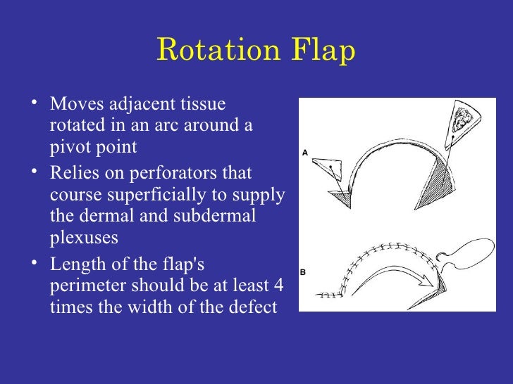 145d Coclia99 Grafts And Flaps