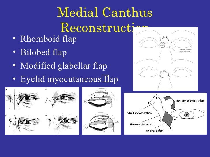 145d Coclia99 Grafts And Flaps