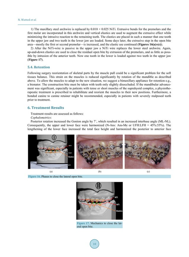 A Therapeutic Concept by “Watted” for the Surgical Lengthening of the ...