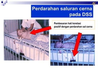 146470448 demam-berdarah-dengue | PPT