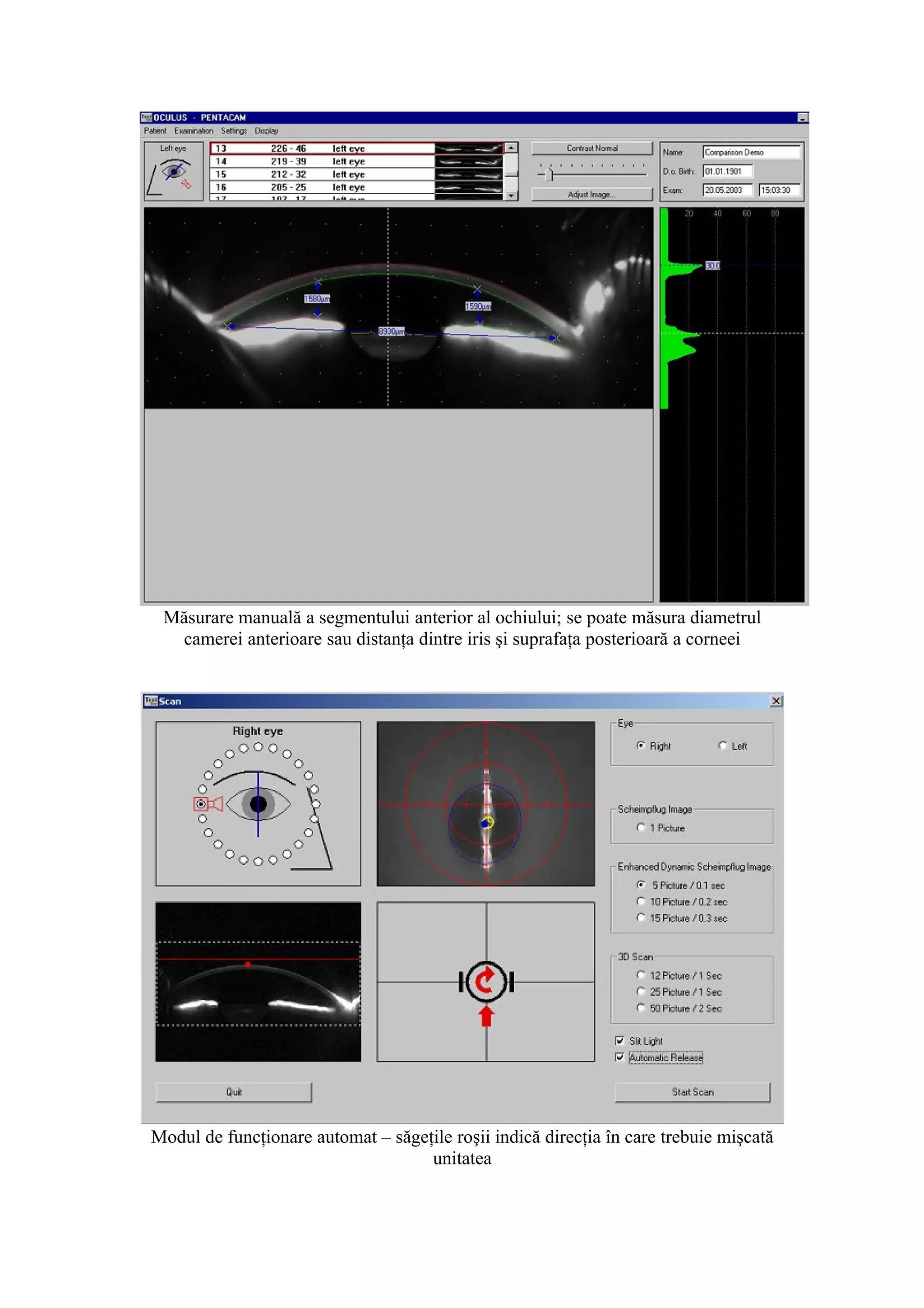 147075640 keratometria | PDF