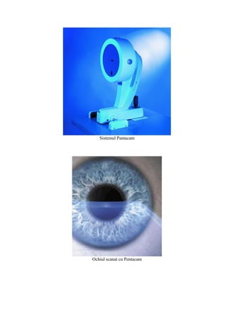 147075640 keratometria | PDF