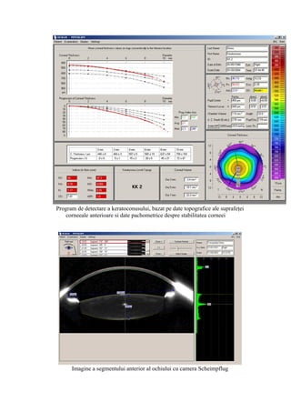 147075640 keratometria | PDF