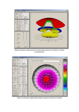 147075640 keratometria | PDF