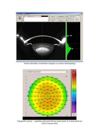 147075640 keratometria | PDF
