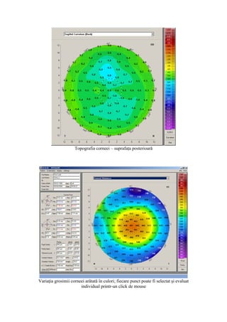 147075640 keratometria | PDF