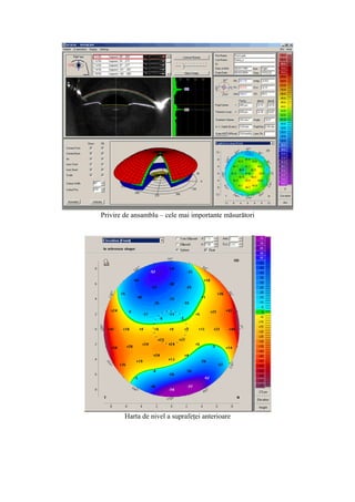 147075640 keratometria | PDF
