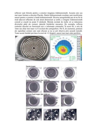 147075640 keratometria | PDF