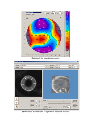 147075640 keratometria | PDF