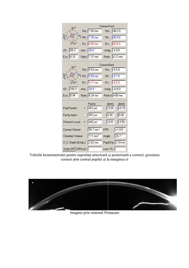 147075640 keratometria | PDF