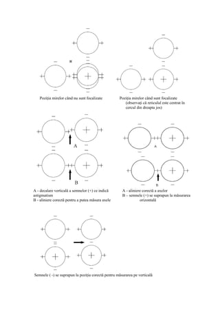 147075640 keratometria | PDF