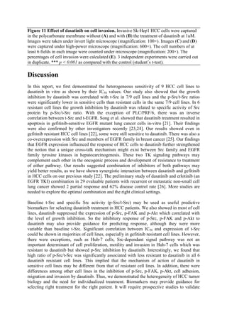 Molecular mechanisms of action and potential biomarkers of growth inhibition of dasatinib (BMS ...