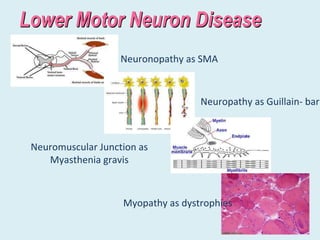 1479106810-dr.farzad-ahmadabadi-guillain-barre-syndrome.ppt