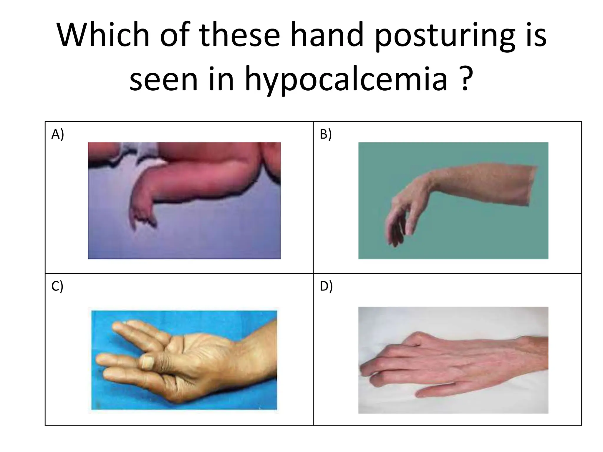1479713317-hypocalcemia low calcium .ppt